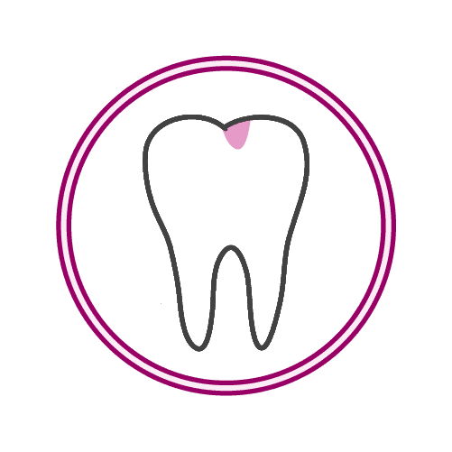 Karies vermeiden ️ Tipps zur Karies Behandlung ️